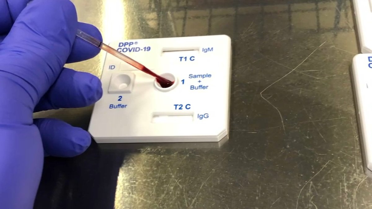 Local Chemist Helps Develop Rapid COVID-19 Antibody Test – NBC Boston