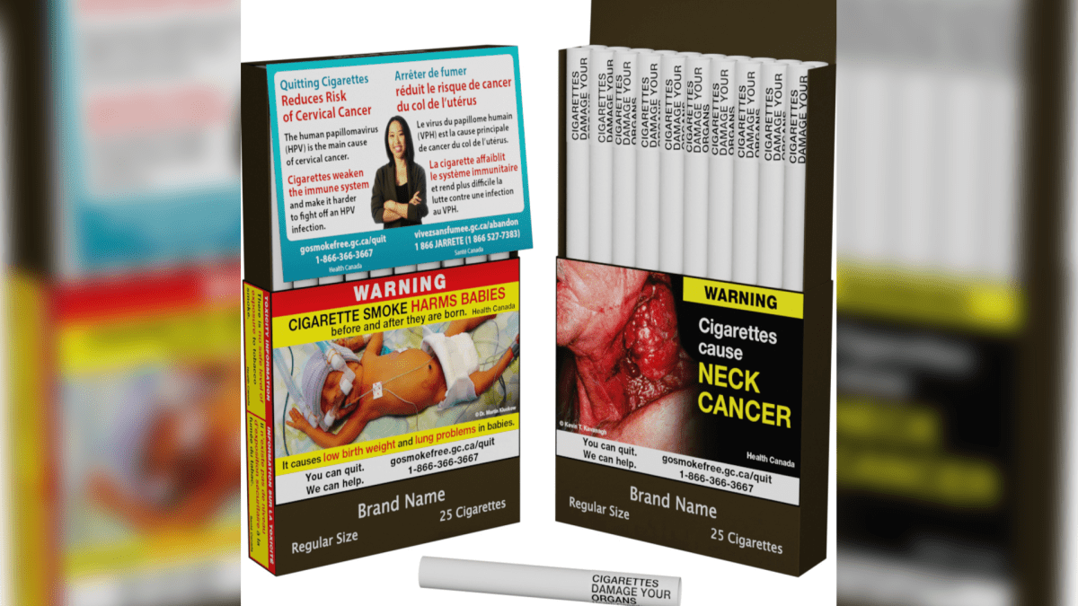 Canada Unveils World’s First Individual Cigarette Warning Labels – NBC Boston