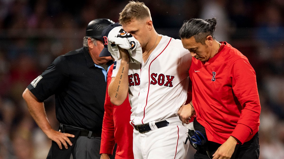 Red Sox’ Tanner Houck to undergo surgery after suffering facial ...