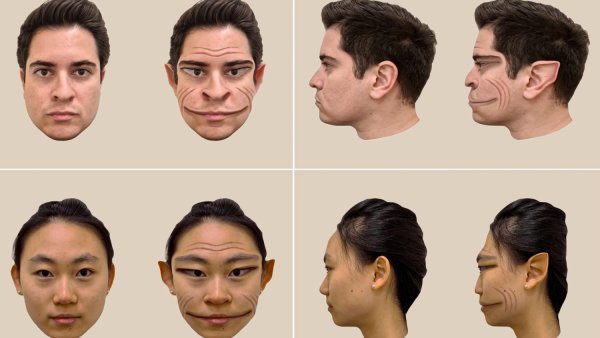 Rare disorder causes man to see ‘demonic’ faces – NBC Boston