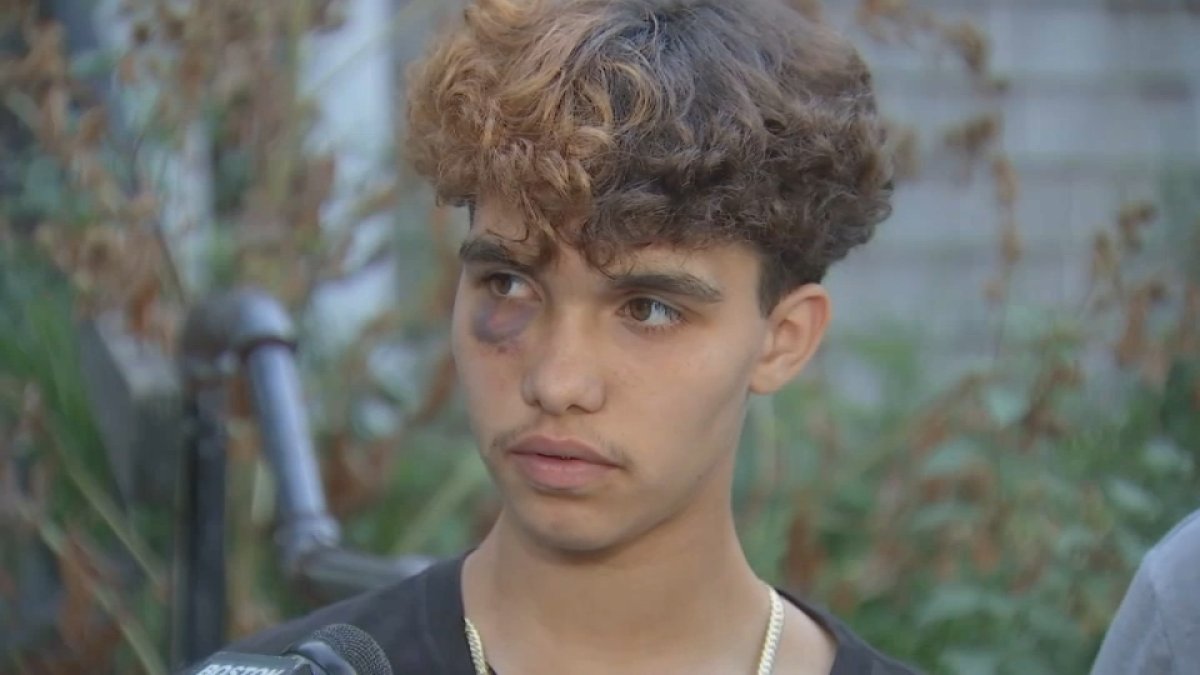 Gloucester, MA trans teen assault: Competing narratives – NBC Boston