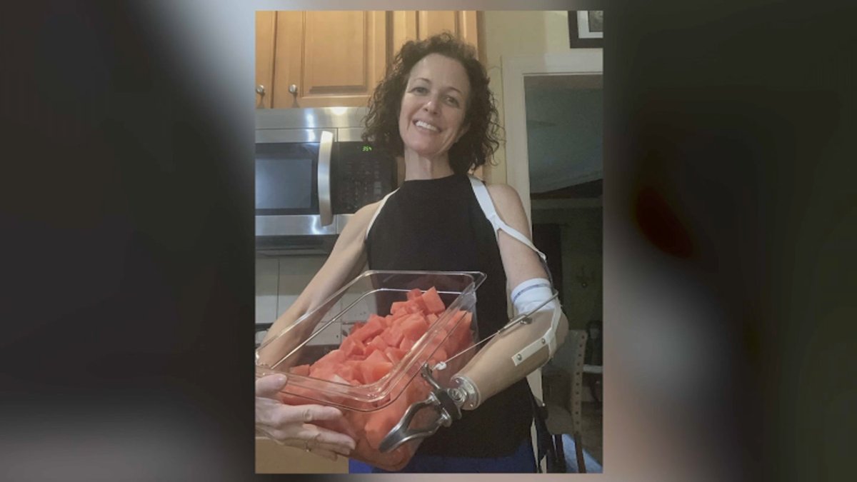 Woman who lost hand in shark attack denied claim for prosthetic – NBC ...
