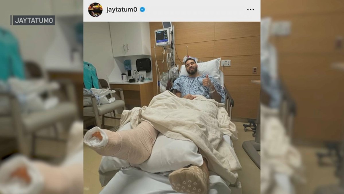 Mapping out Jayson Tatum’s road to recovery – NBC Boston